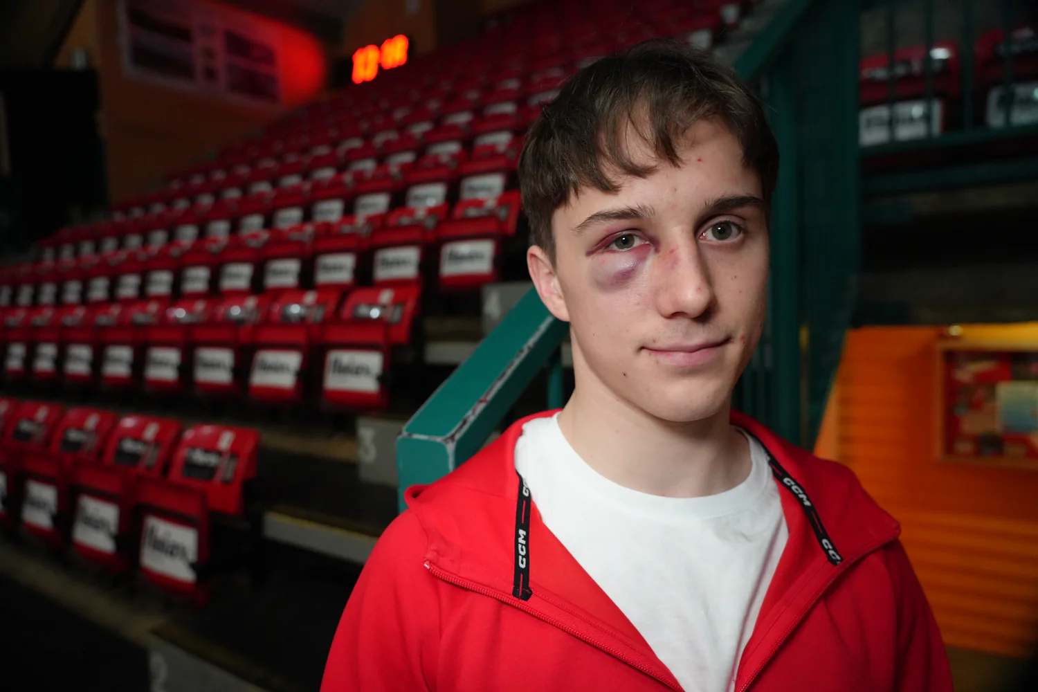 Stjernen dropper anmeldelse etter hockeyslagene - TV 2